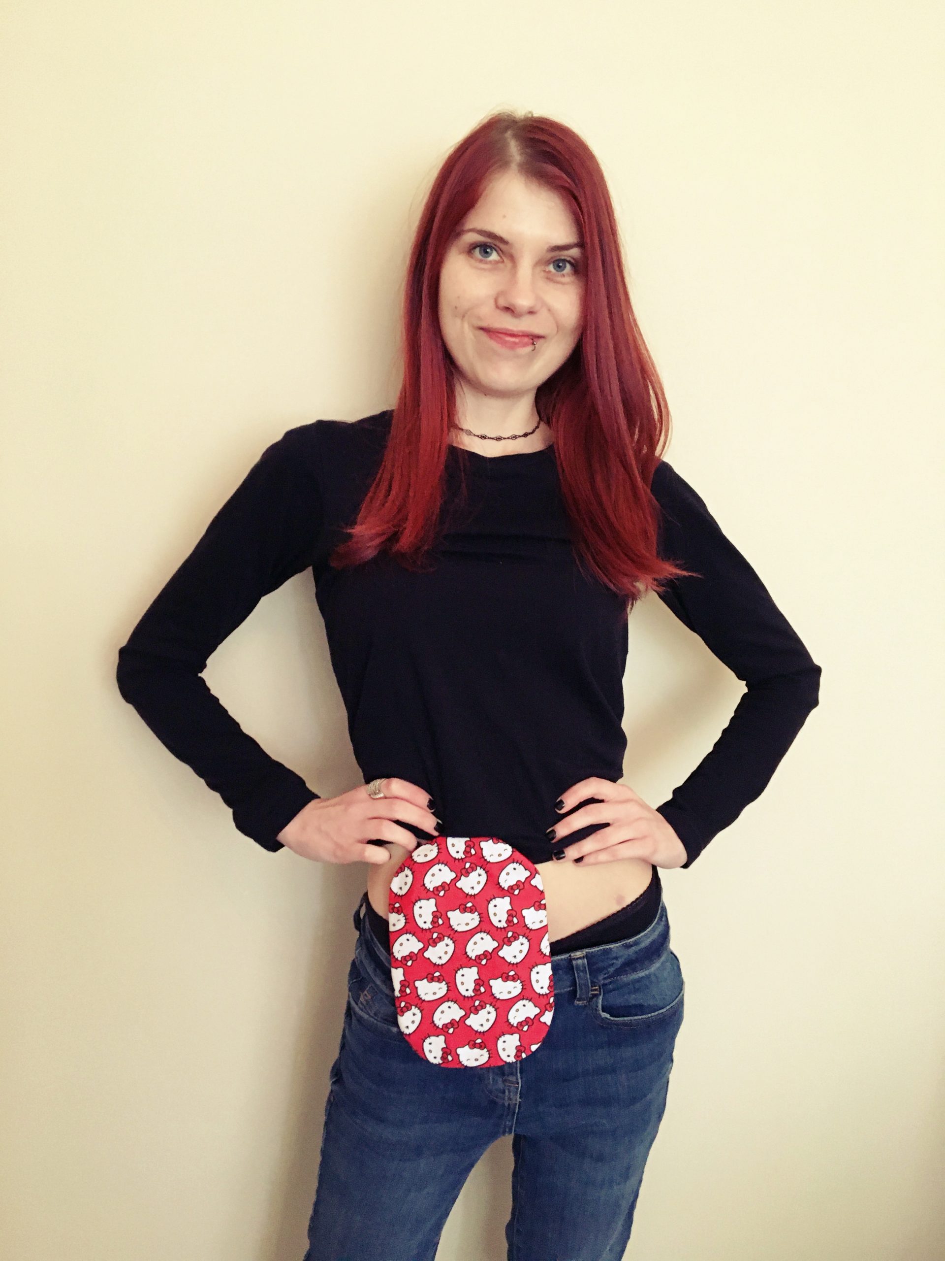 Stoma Life : A Unique & Individual Ostomy Experience - Invisibly Me